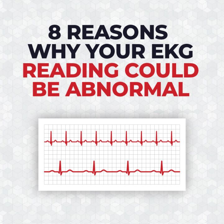 ecg reading not normal