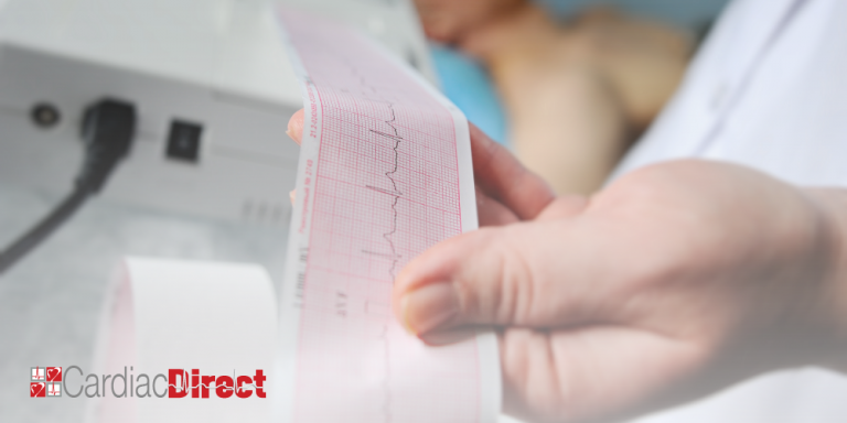 What Exactly is Glasgow Interpretation ? - CardiacDirect