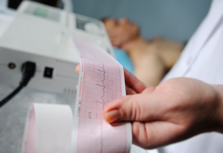 8 Reasons Why Your EKG Reading Could be Abnormal - CardiacDirect