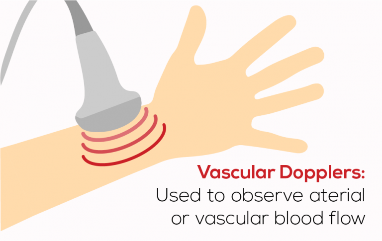 What is a Doppler? An Intro into Fetal Dopplers- CardiacDirect