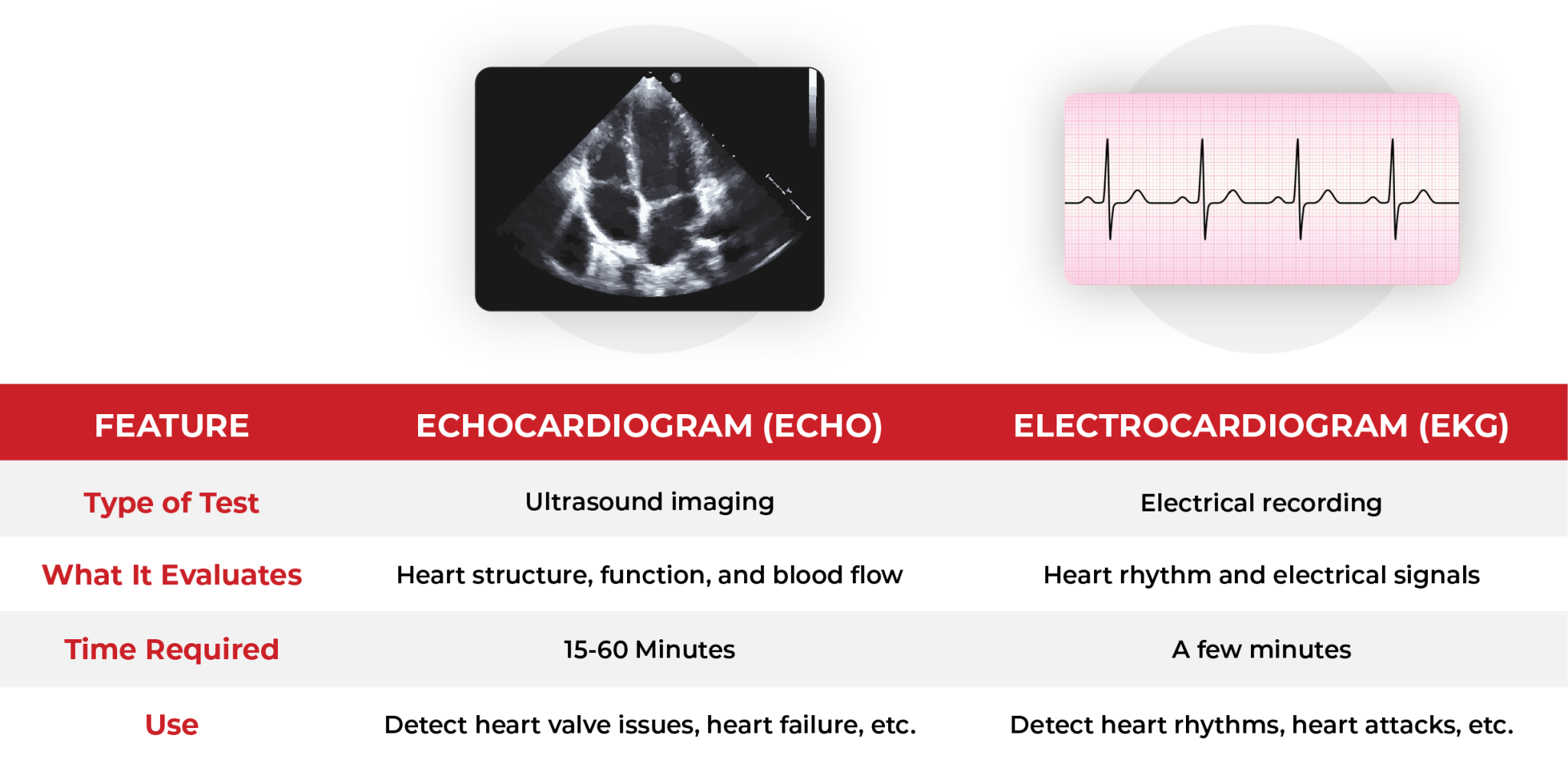 Echocardiogram vs. EKG/ECG: What's the Difference? - CardiacDirect