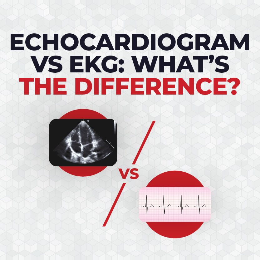 Echocardiogram vs. EKG/ECG: What's the Difference? - CardiacDirect