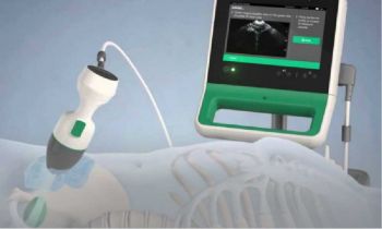 What is Bladder Scanning and What Are The Benefits?