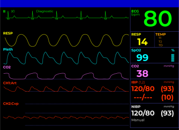 How to Read a Patient Monitor: Numbers and Lines Explained