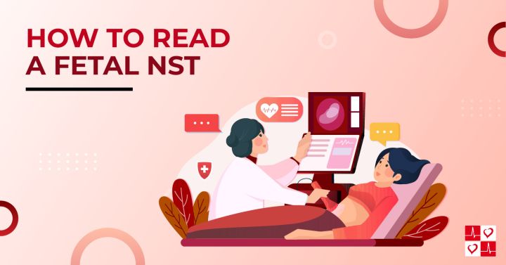 How to Read a Fetal Non-Stress Test (NST) - CardiacDirect