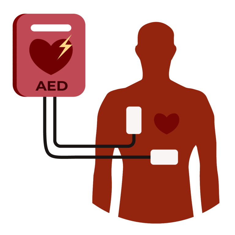 Why is Rapid Defibrillation Important? - CardiacDirect