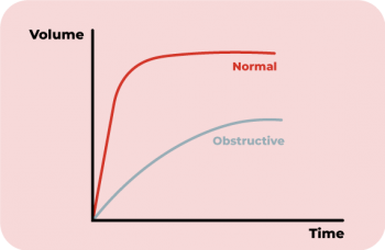 How to Interpret a Spirometry Test - CardiacDirect