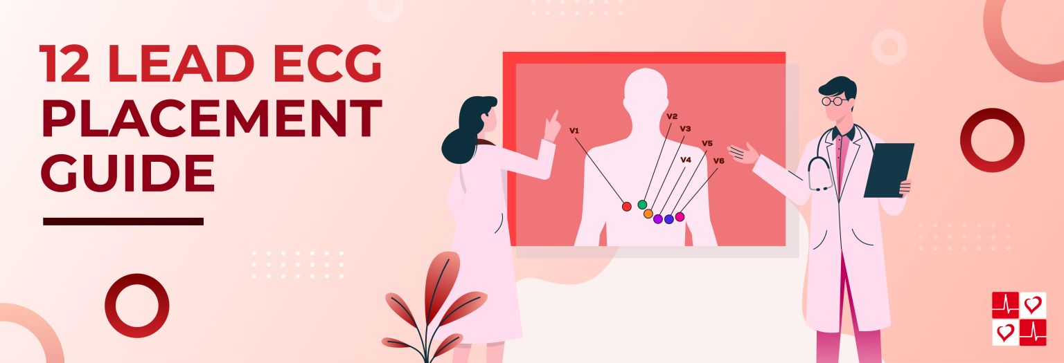 12-Lead ECG Placement Guide - CardiacDirect