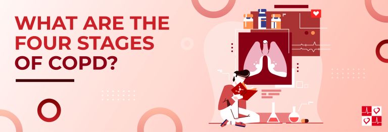 What are the 4 Stages of COPD? - CardiacDirect