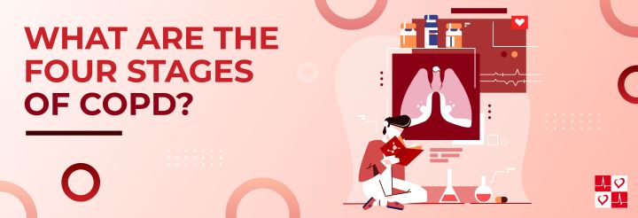 What are the 4 Stages of COPD? - CardiacDirect