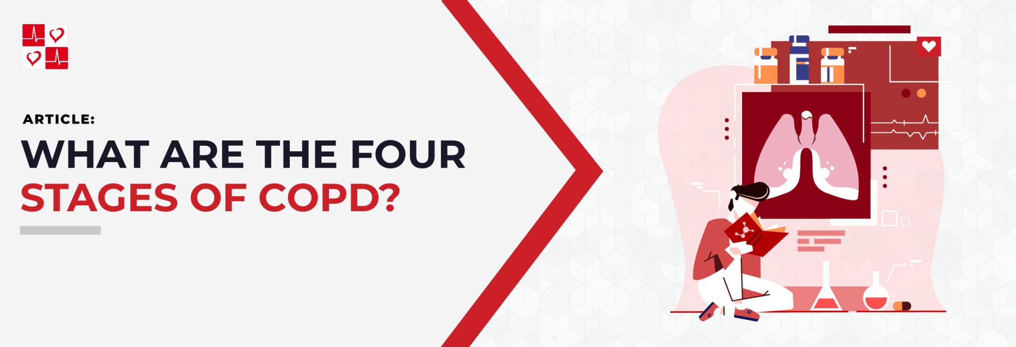 What are the 4 Stages of COPD? - CardiacDirect