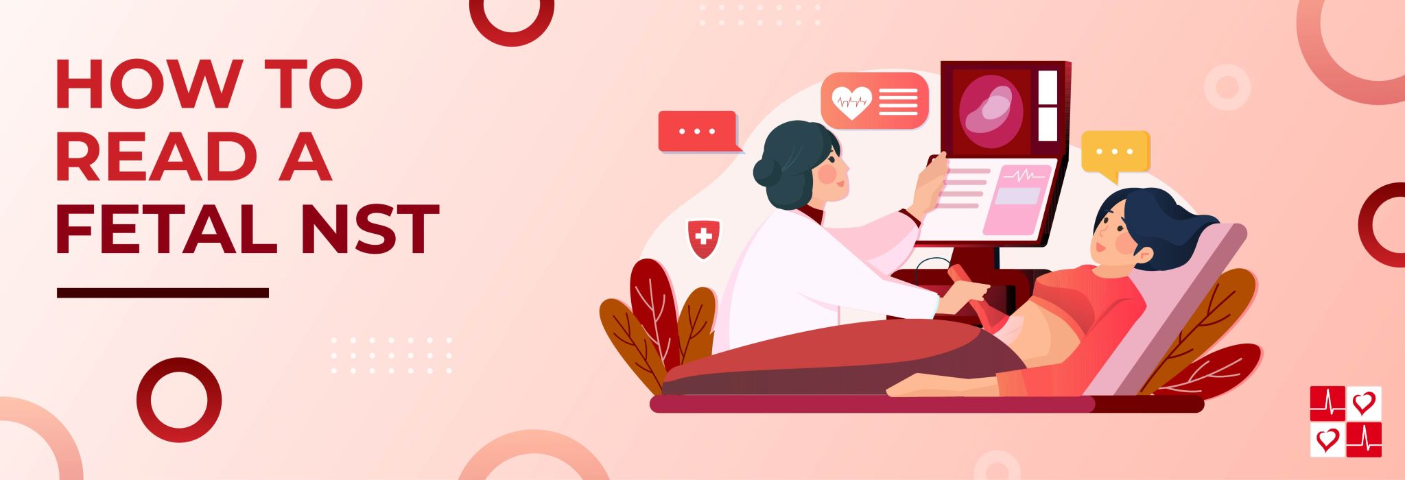 How to Read a Fetal Non-Stress Test (NST) - CardiacDirect