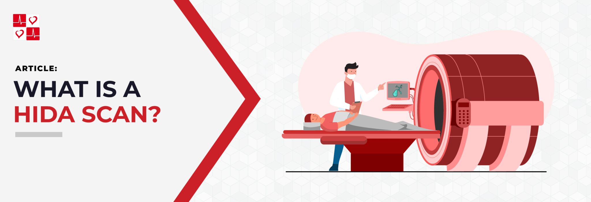 What is a HIDA Scan? - CardiacDirect