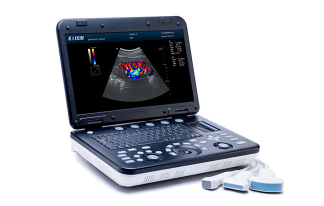 Kaixin KC7 Diagnostic Ultrasound System - CardiacDirect