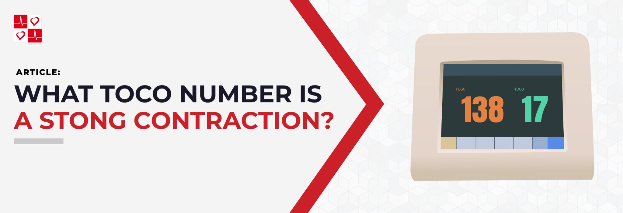 What TOCO Number is a Strong Contraction? - CardiacDirect