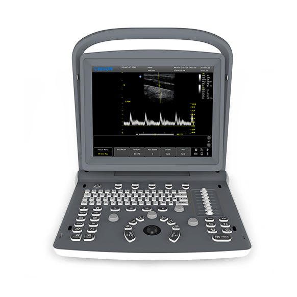 Chison ECO 2 Portable Ultrasound Machine - CardiacDirect