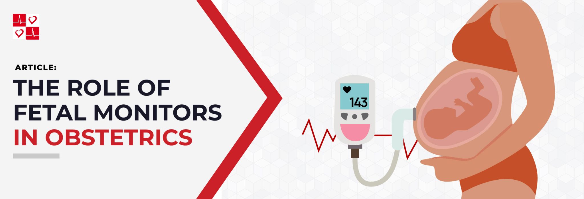 The Role of Fetal Monitors in Obstetrics - CardiacDirect